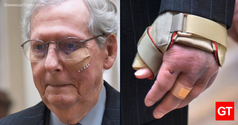 Following traumatic fall, Mitch McConnell says he will continue to ...